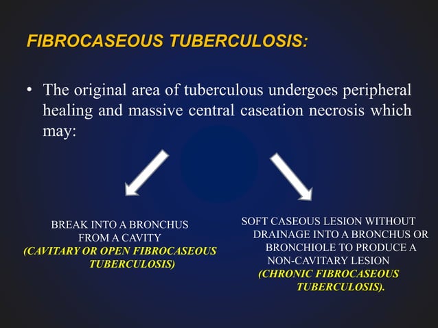 Tuberculosis | PPSX