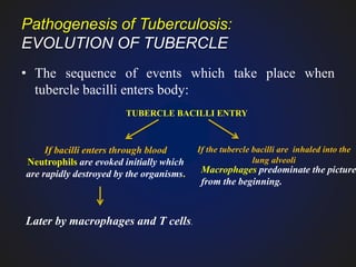 Tubercle Tuberculosis