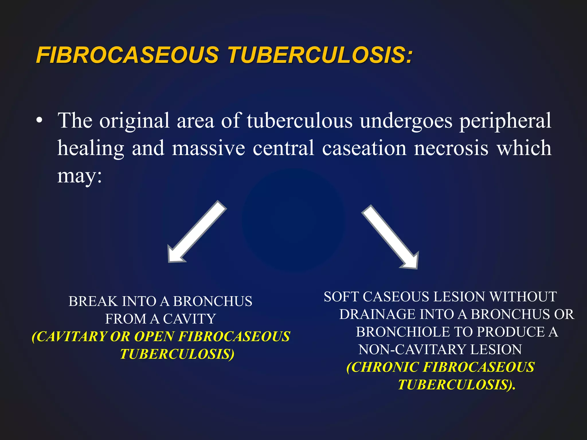 Tuberculosis | PPTX