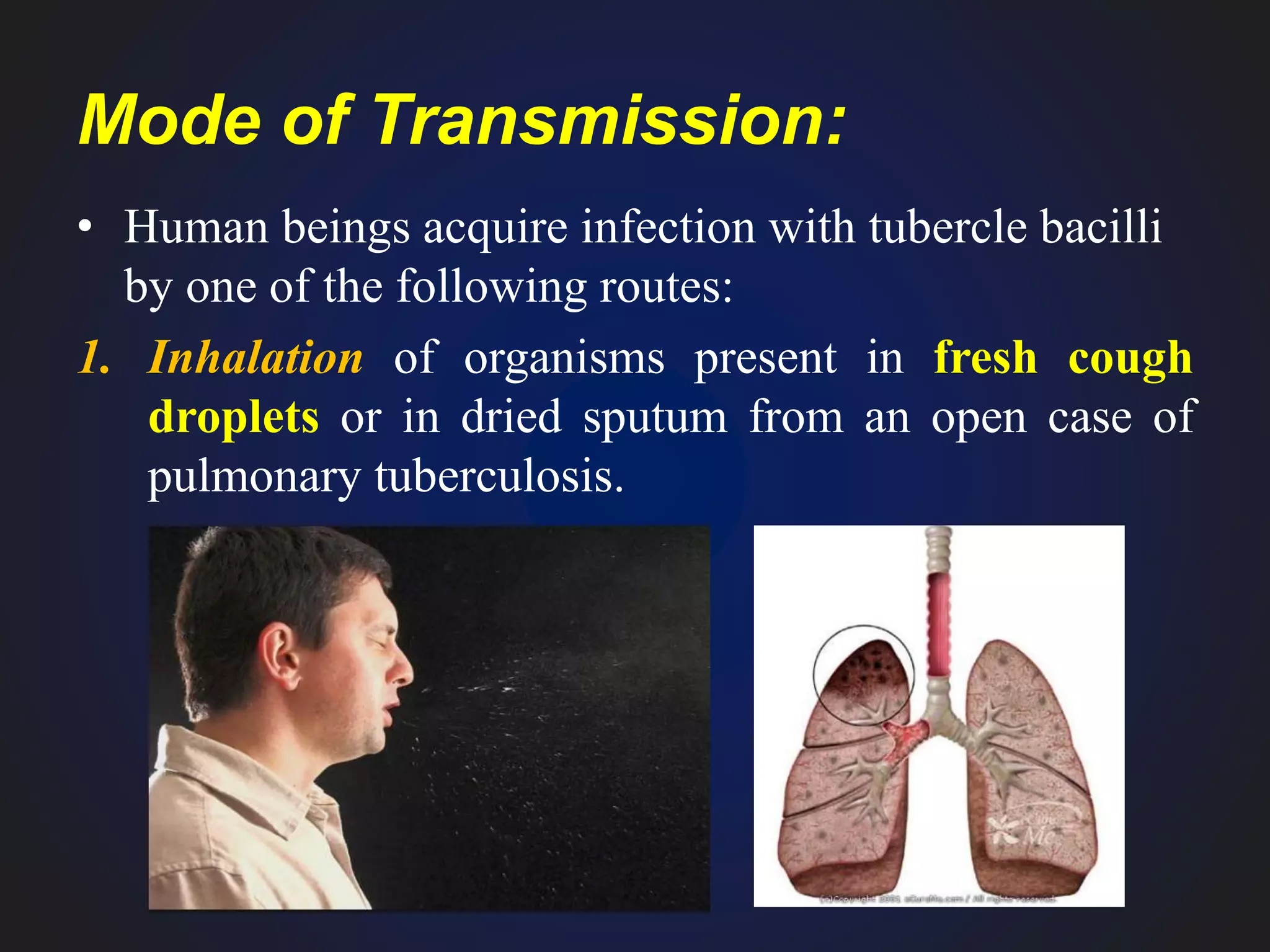 Tuberculosis | PPTX
