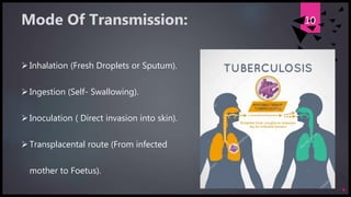 Tuberculosis | PPTX
