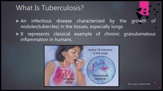 Tuberculosis | PPT