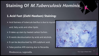 Tuberculosis | PPT
