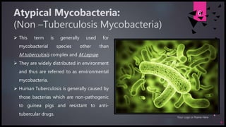 Tuberculosis | PPT