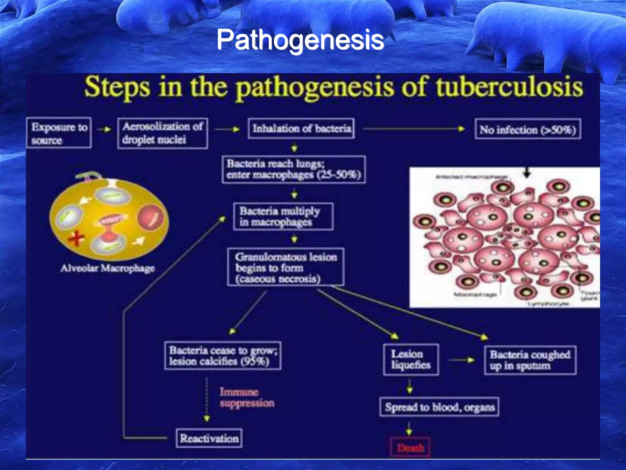 Pathophysiology Tuberculosis | PPTX