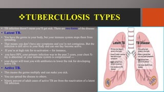 Tuberculosis | PPTX