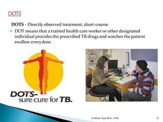 Tuberculosis | PPTX