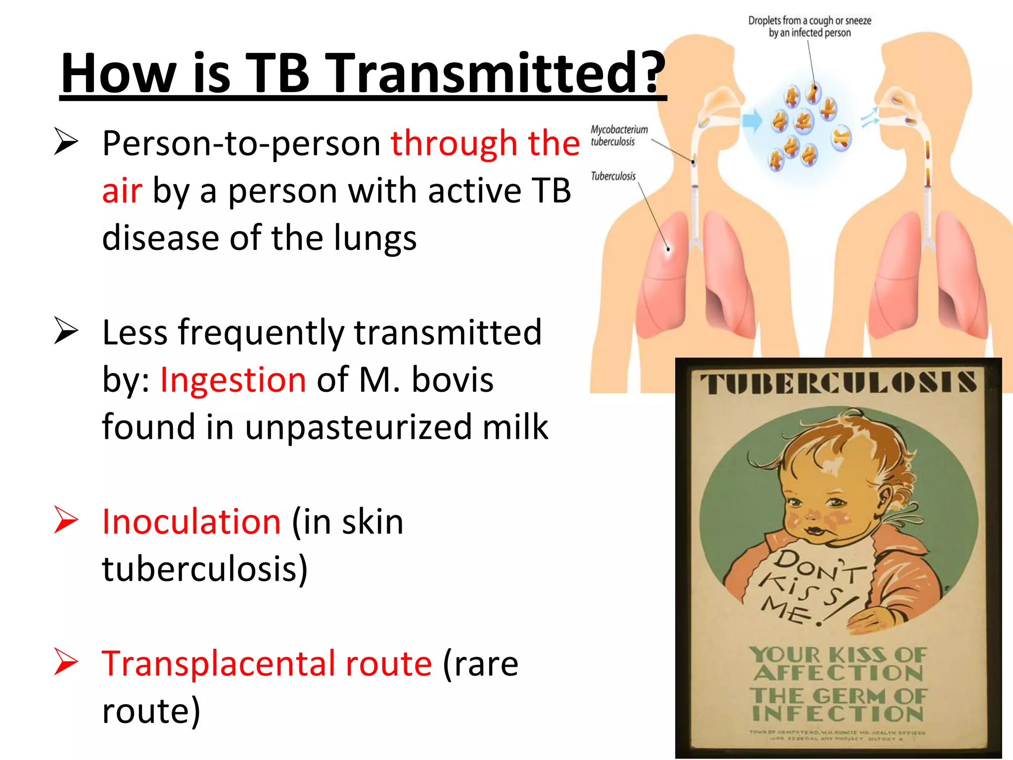 Tuberculosis | PDF
