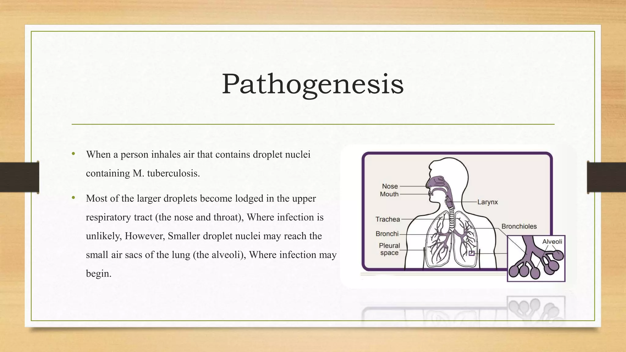 Tuberculosis | PPTX