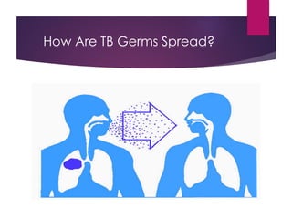 Tuberculosis | PPT