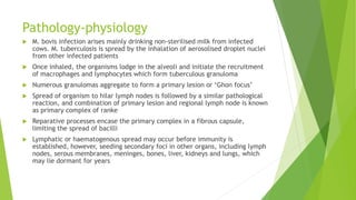 Pulmonary Tuberculosis.pptx