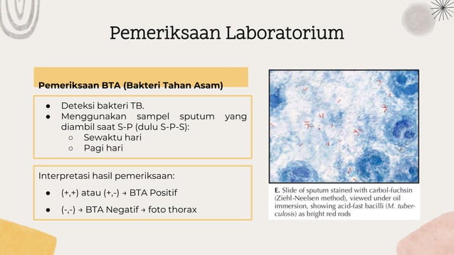 Tuberculosis.pptx