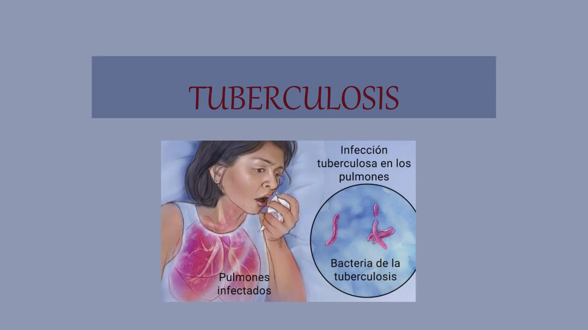 Tuberculosis.pptx
