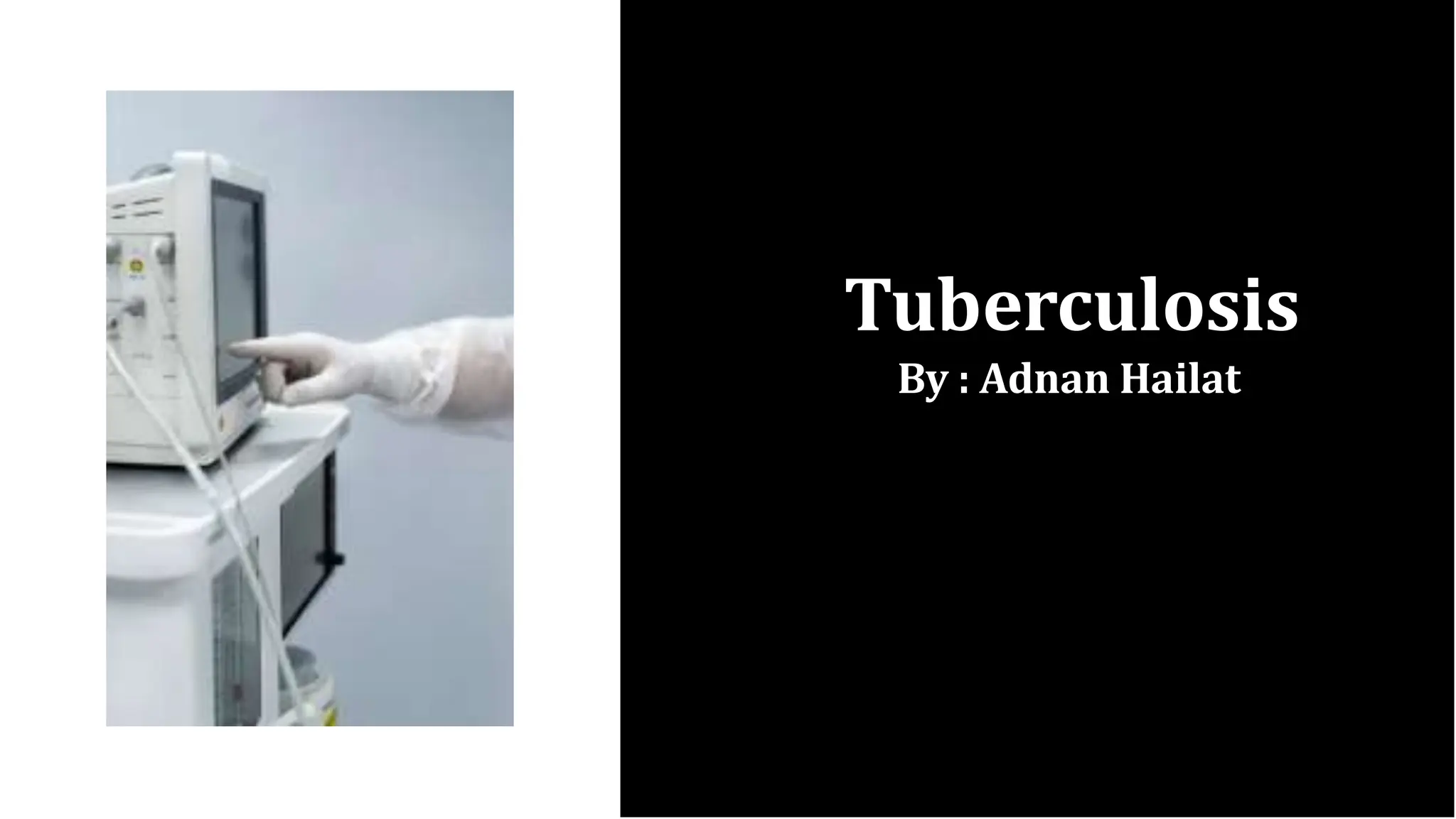 microbiology tuberculosis presentation.. | PPTX