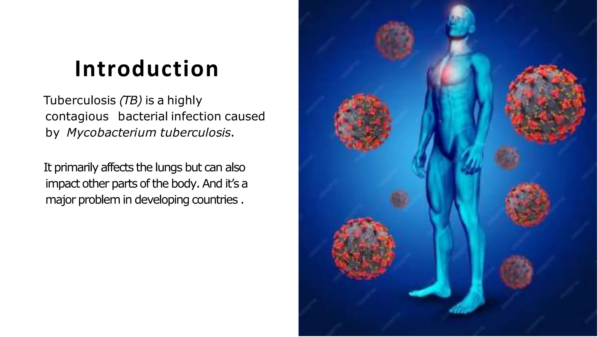 microbiology tuberculosis presentation.. | PPTX