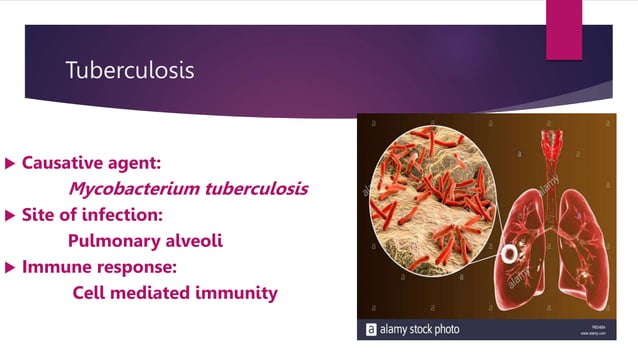 Tuberculosis,its causative agent,mode of spread,symptoms and treatment ...