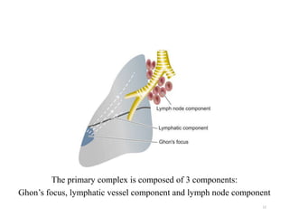 TUBERCULOSIS pharmacology notes types cure | PPTX