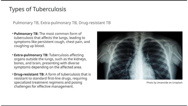 classes and importance of tuberculosis.pptx