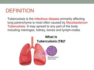 TUBERCULOSIS - communicable disease.pptx