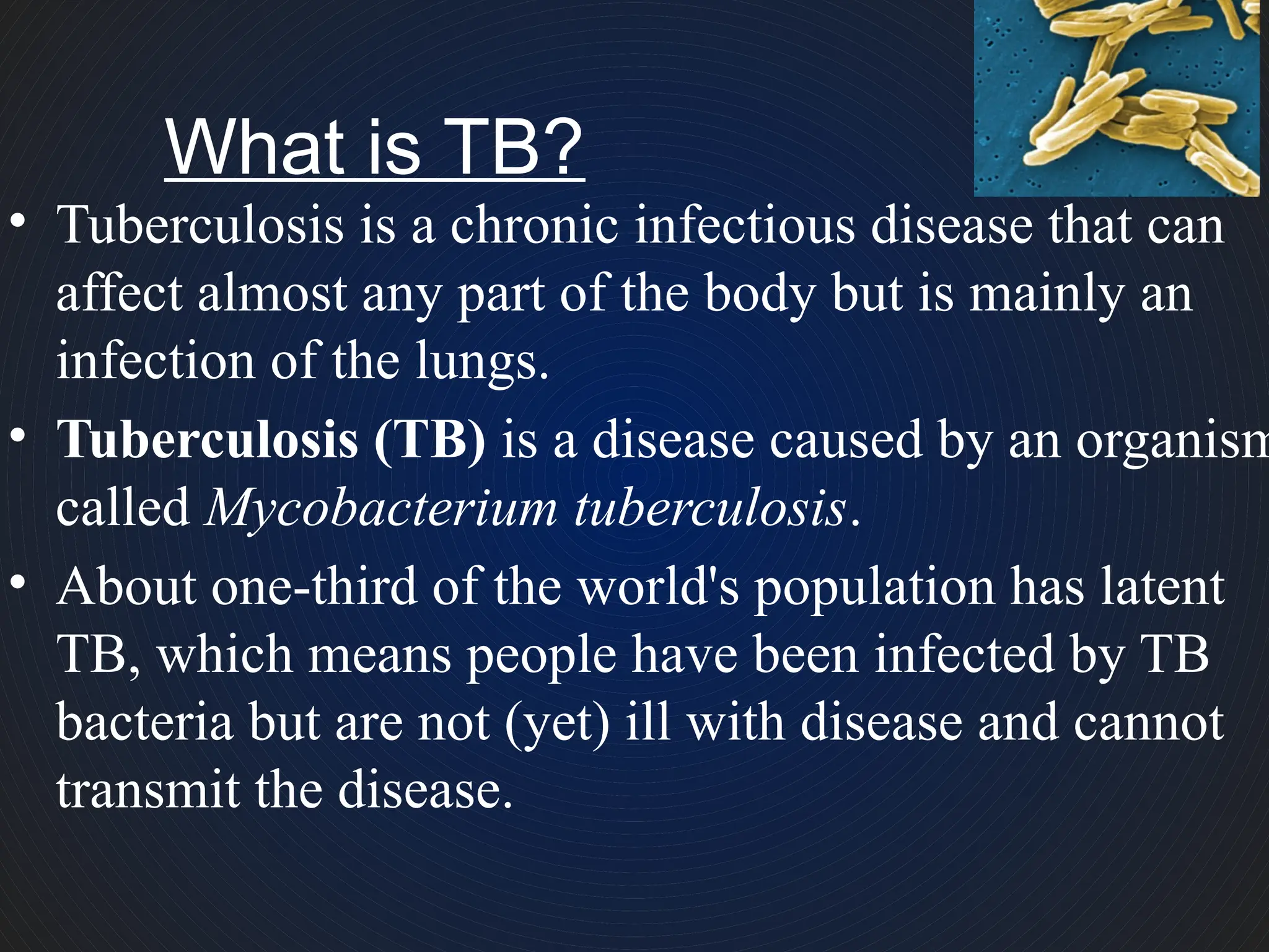 tuberculosis.pptx8888888888888888888888888 | PPTX | Infectious Diseases ...