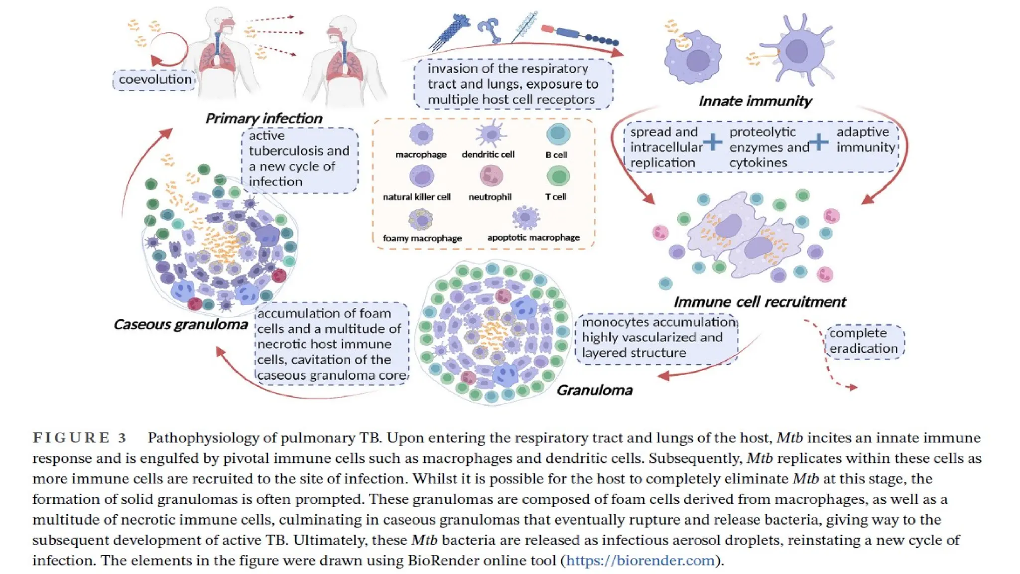Tuberculosis management, pathophysiology and treatment.pptx