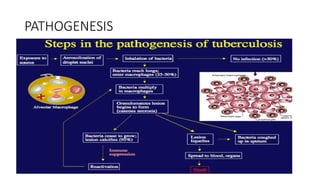 TUBERCULOSIS- clinical features and management | PPTX