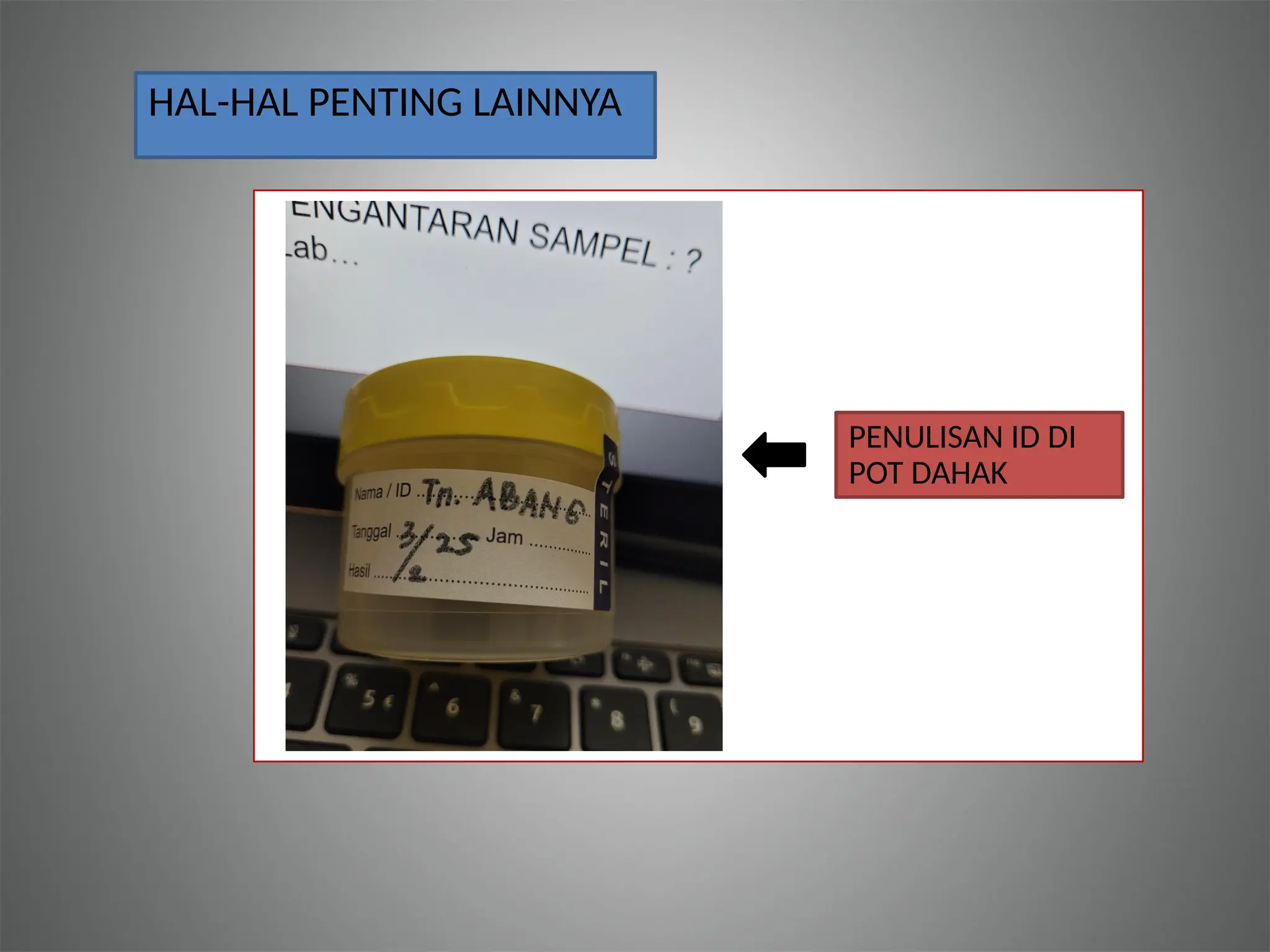 Tuberculosis Ppt Presentasi Rapat Pptx