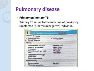 Tuberculosis including all types of tb.pptx