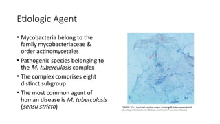 Dr.Mohammed pulmonary TUBERCULOSIS .pptx
