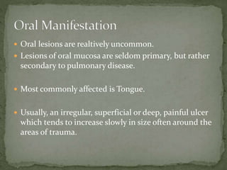 Tuberculosis- Oral Pathology | PPTX
