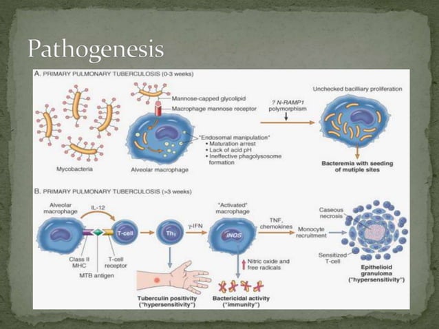 Tuberculosis Oral Pathology