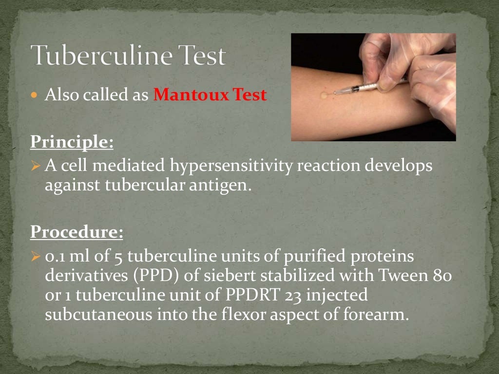 Tuberculosis Oral Pathology