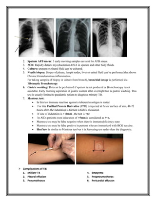 Pulmonary Tuberculosis | PDF