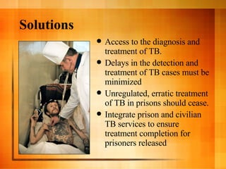 TB in prisons | PPT