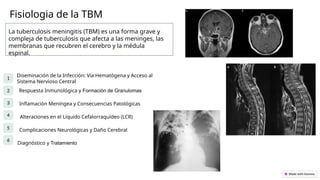 Tuberculosis-Meningitis-Un-Desafio-Critico-en-Salud-Publica-1.pptx