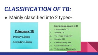 TUBERCULOSIS - complete information ppts | PPT