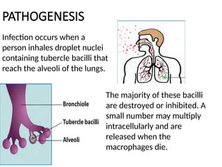TUBERCULOSIS symptoms, diagnosis, treatment | PPT