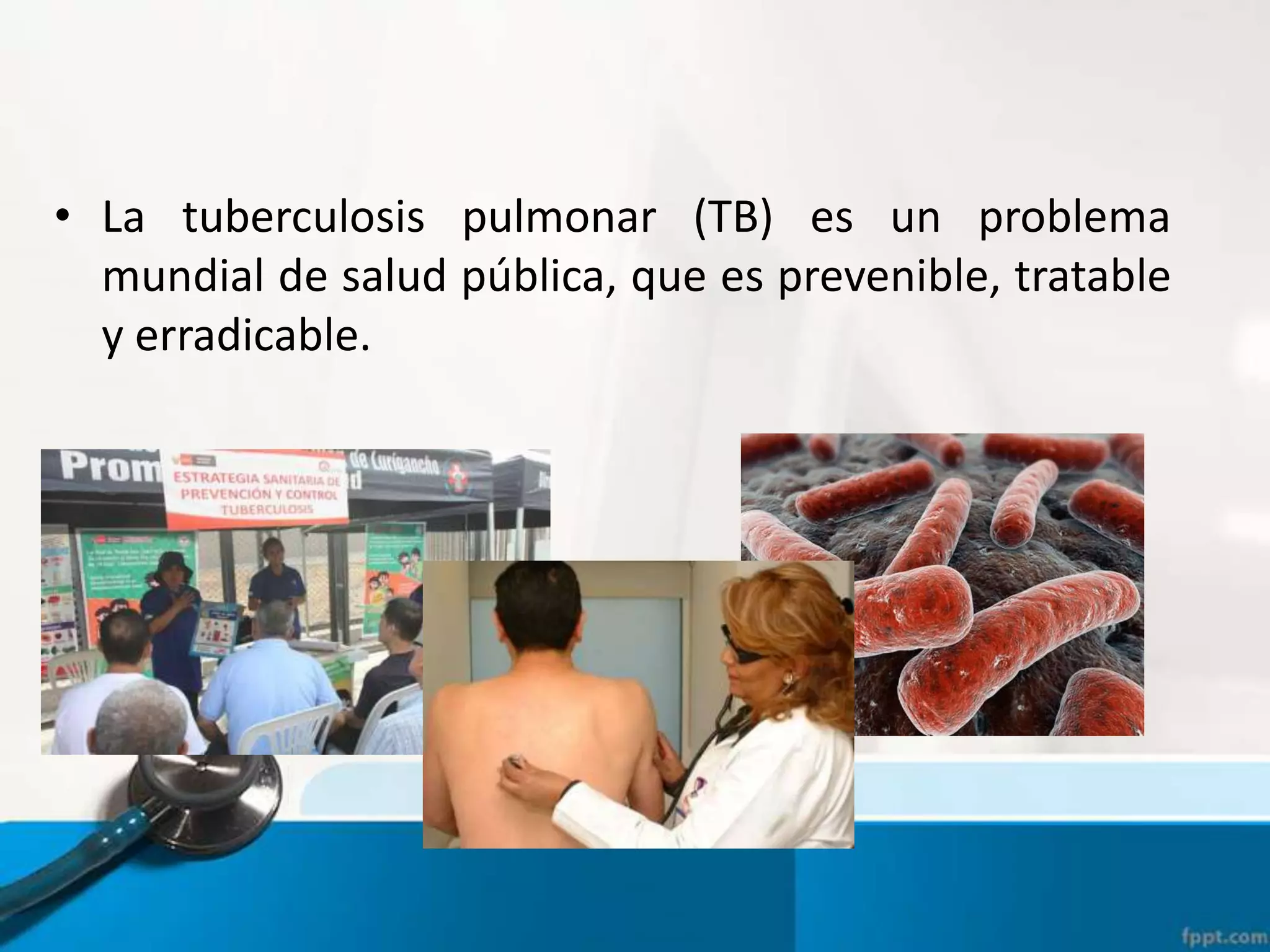 Tuberculosis Pulmonar | PPT