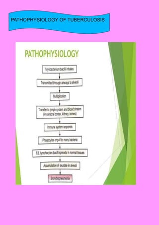 Tuberculosis | PDF