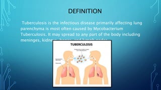 Tuberculosis, Department of Physiotherapy, SHUATS, Prayagraj | PPTX ...