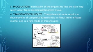 Tuberculosis, Department of Physiotherapy, SHUATS, Prayagraj | PPTX
