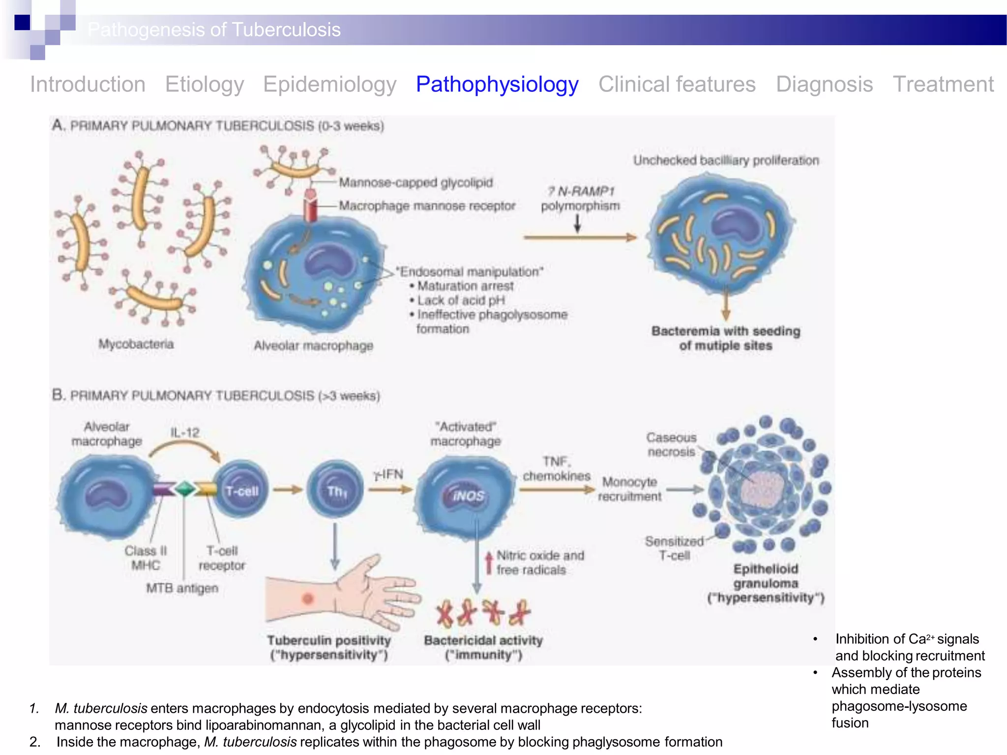 tuberculosis .pptx