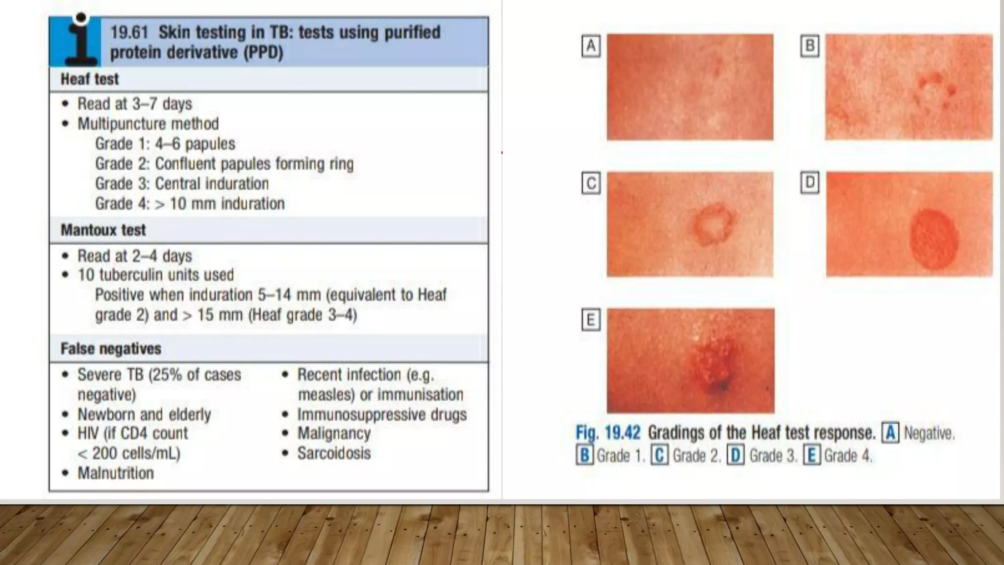 tuberculosis (2).pdf
