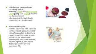 Tuberculosis 2.pptx