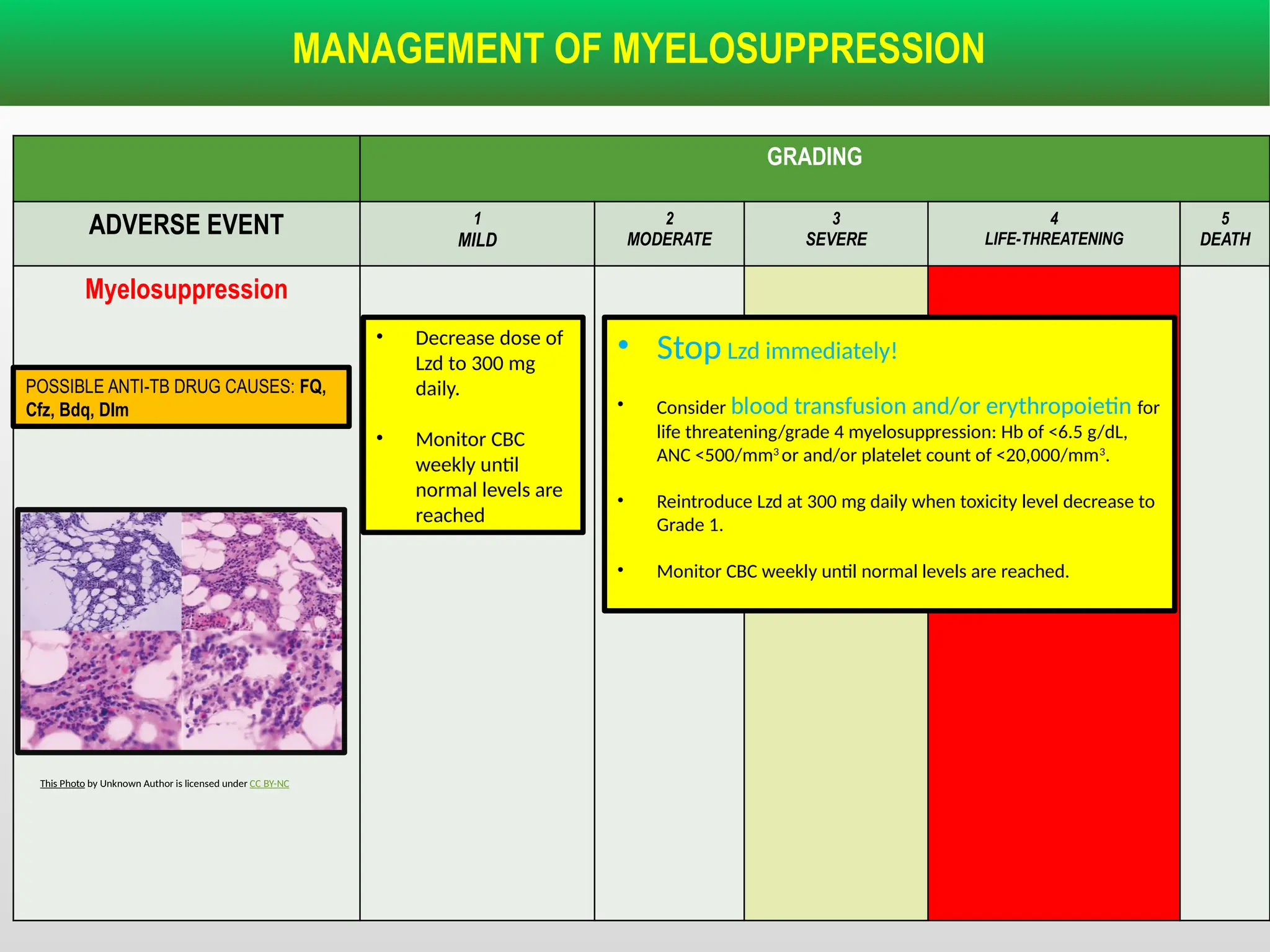 Tuberculosis Adverse Drug Reaction Management.pptx