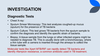 TB/Tuberculosis/ tb in detail/all you need to know about tuberculosis ...