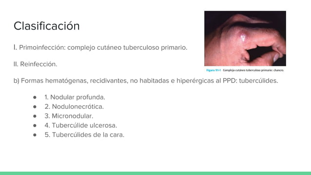 Tuberculosis cutanea | PDF