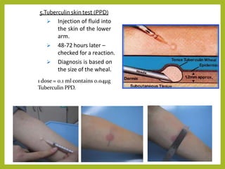 tuberculosis D.Pharm.pptx