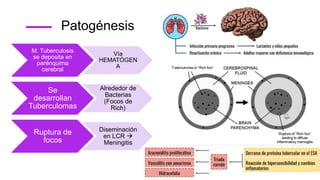 Tuberculosis del sistema nervioso central.pptx