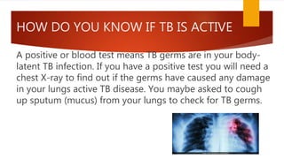 Tuberculosis disease | PPTX